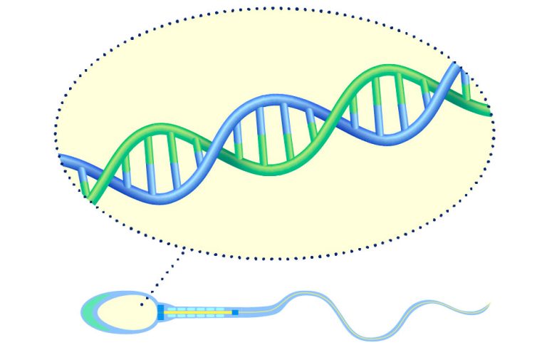 DFI検査とは - 精子の質 改善ラボ