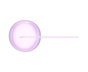 DFI検査とは - 精子の質 改善ラボ
