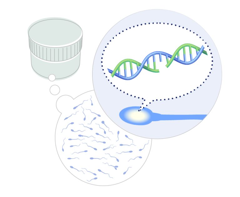 DFI検査とは - 精子の質 改善ラボ